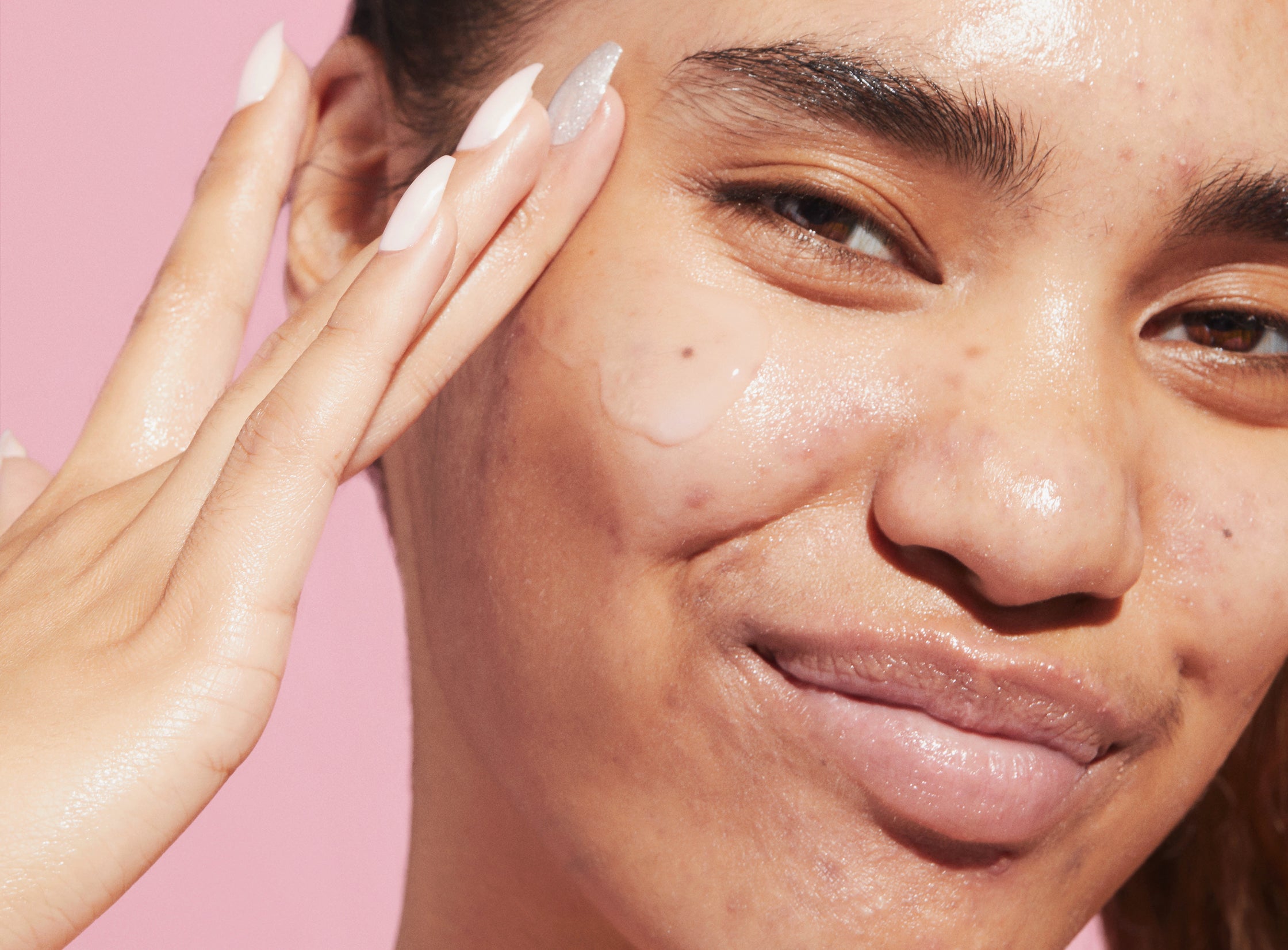 How to Deal with a Zit Before, During, and After a Breakout