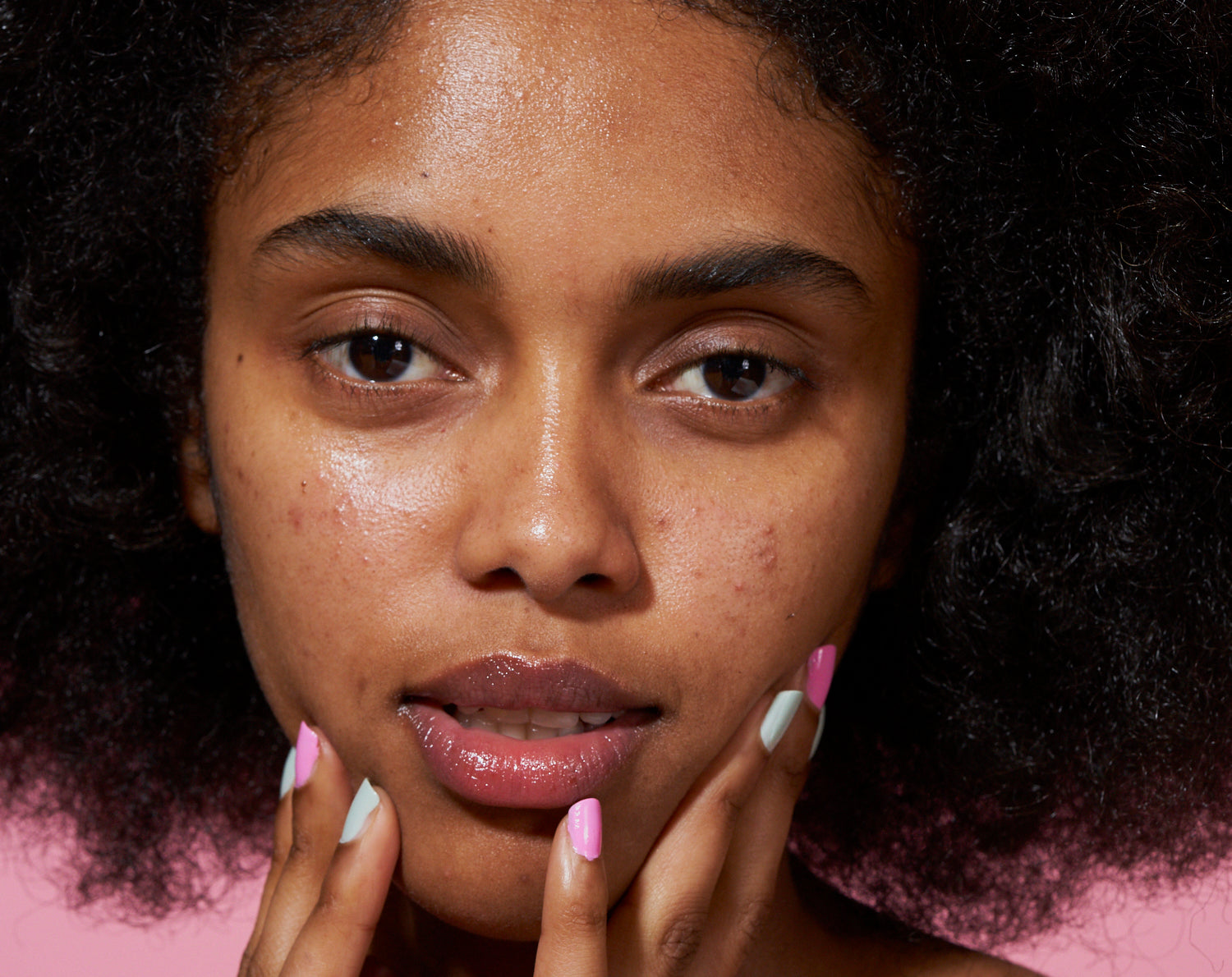 What Redness Looks Like for Different Skin Tones