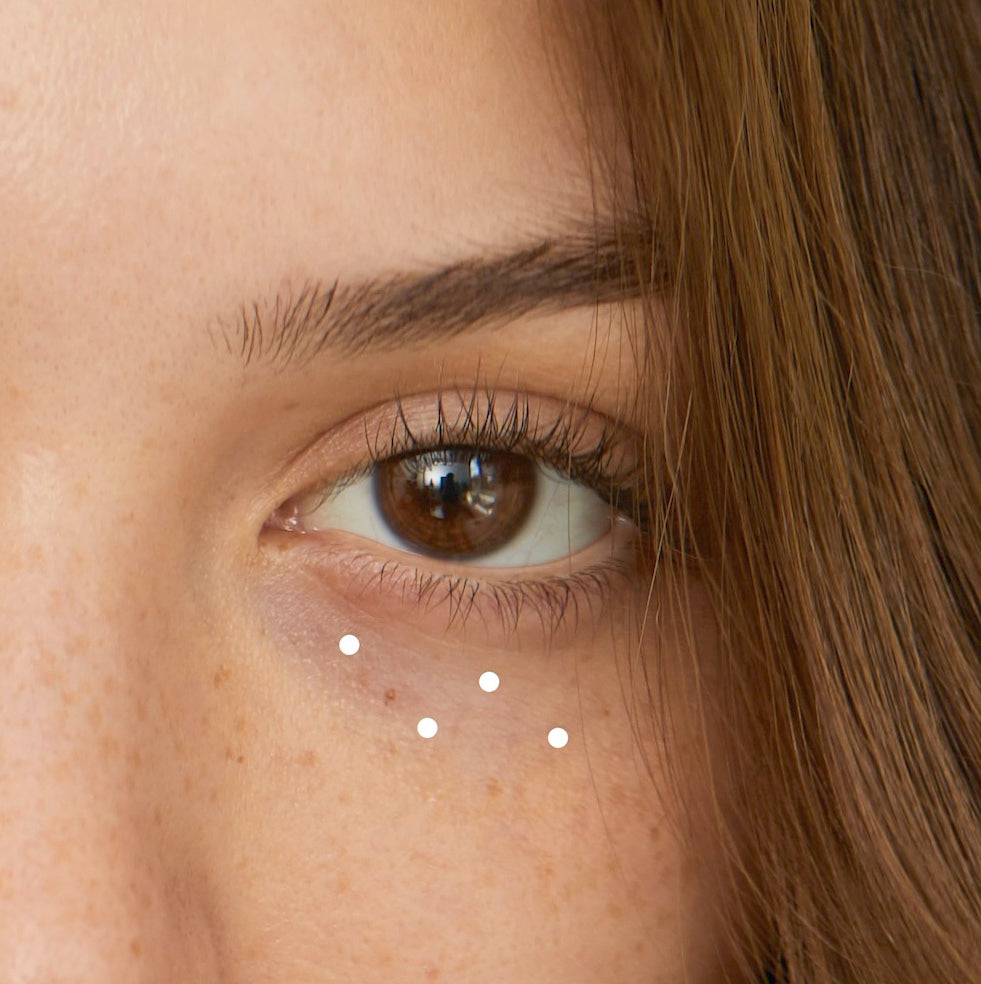 What Is Milia & How Do I Get Rid Of It?