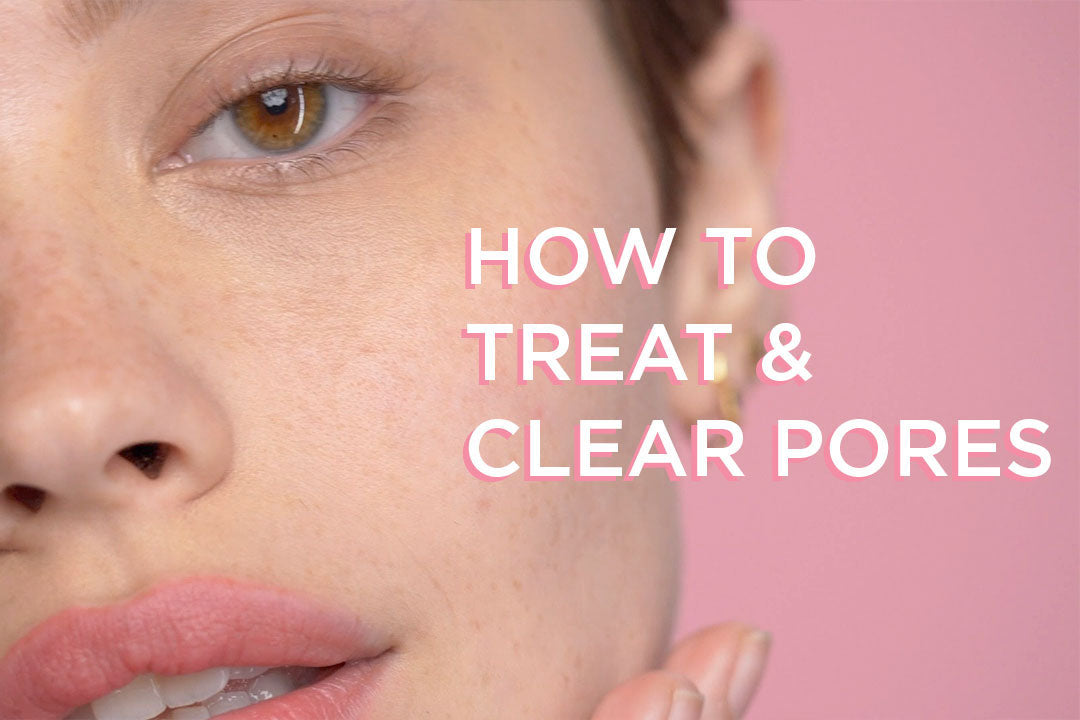 How To Clear & Treat Pores